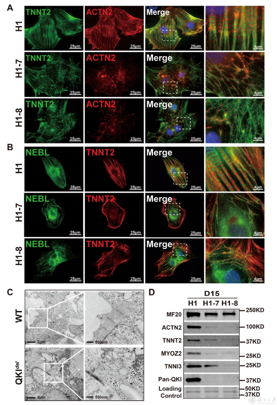 复旦上医孙宁课题组、黄国英课题组合作揭示RNA结合蛋白quaking在心脏肌纤维形成过程中的关键作用